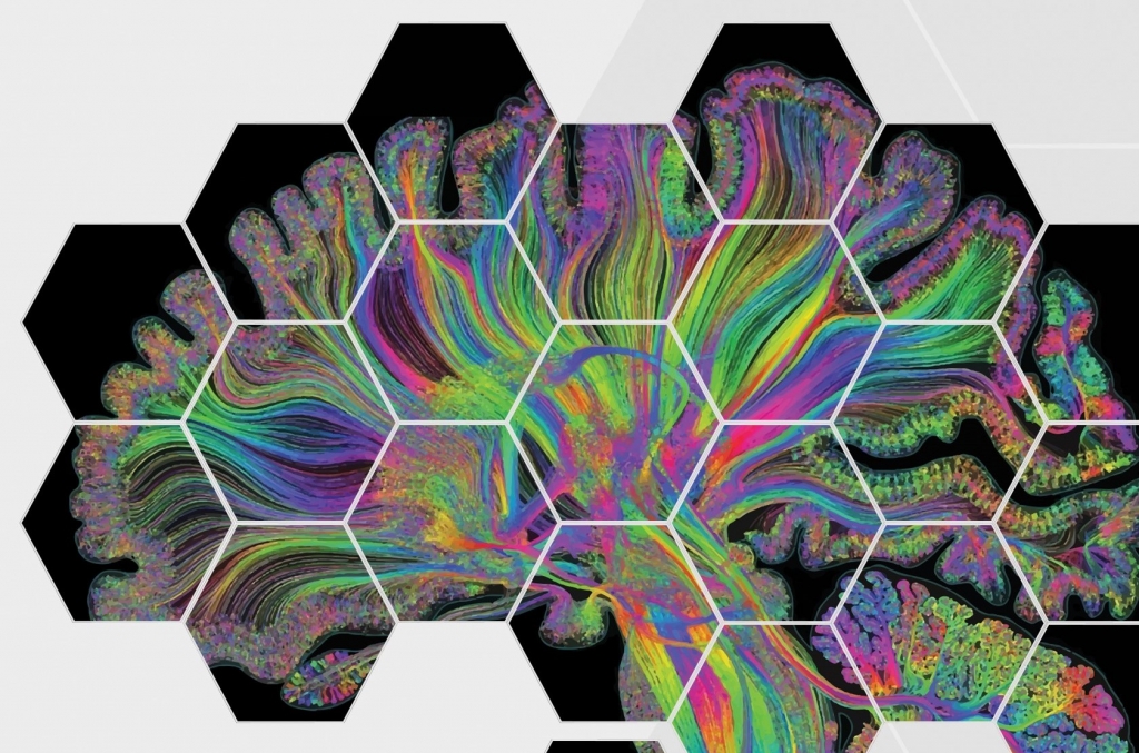 Educational Course NeuroImaging: Mapping the Function and Structure of Brain - Ceitec.cz